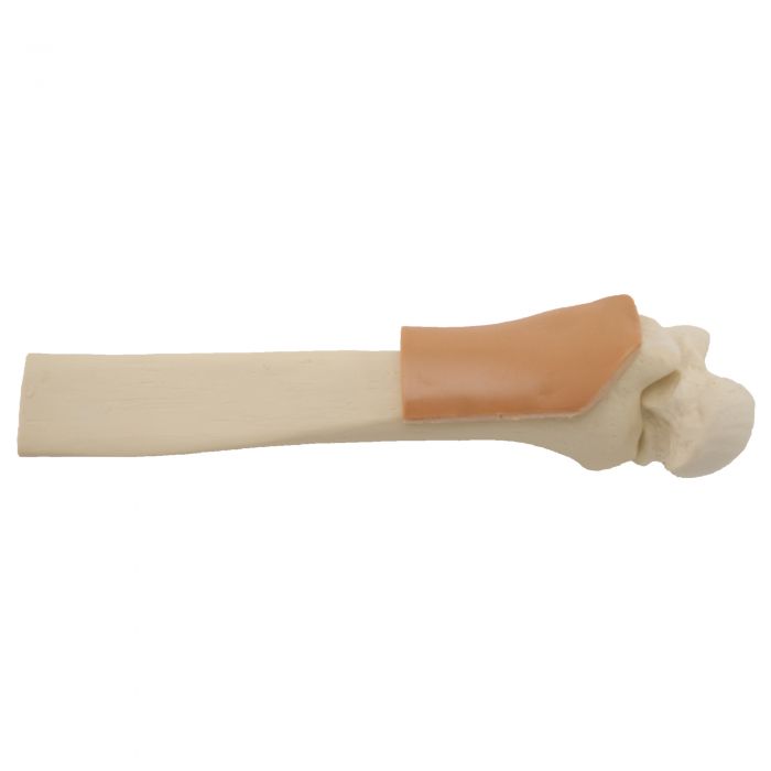 EZ-IO Training Bone (Adult Distal Tibia - with Skin Patch) – TacTree